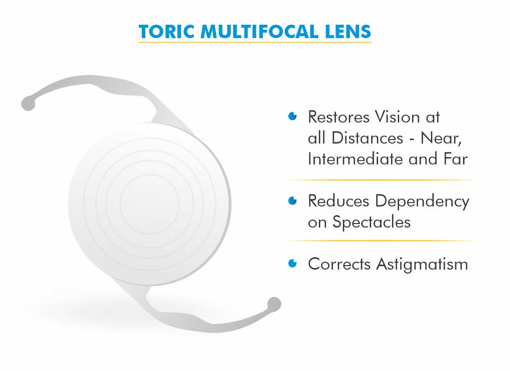 Toric Multifocal Lens IOL For Cataract Motiyabind Surgery 58 OFF Toric Multifocal Lens IOL For Cataract Motiyabind Surgery 58 OFF