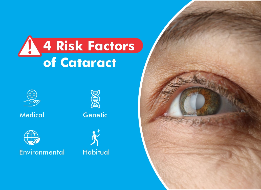 Cataract Risk Factors: Medical, Genetic & Environmental