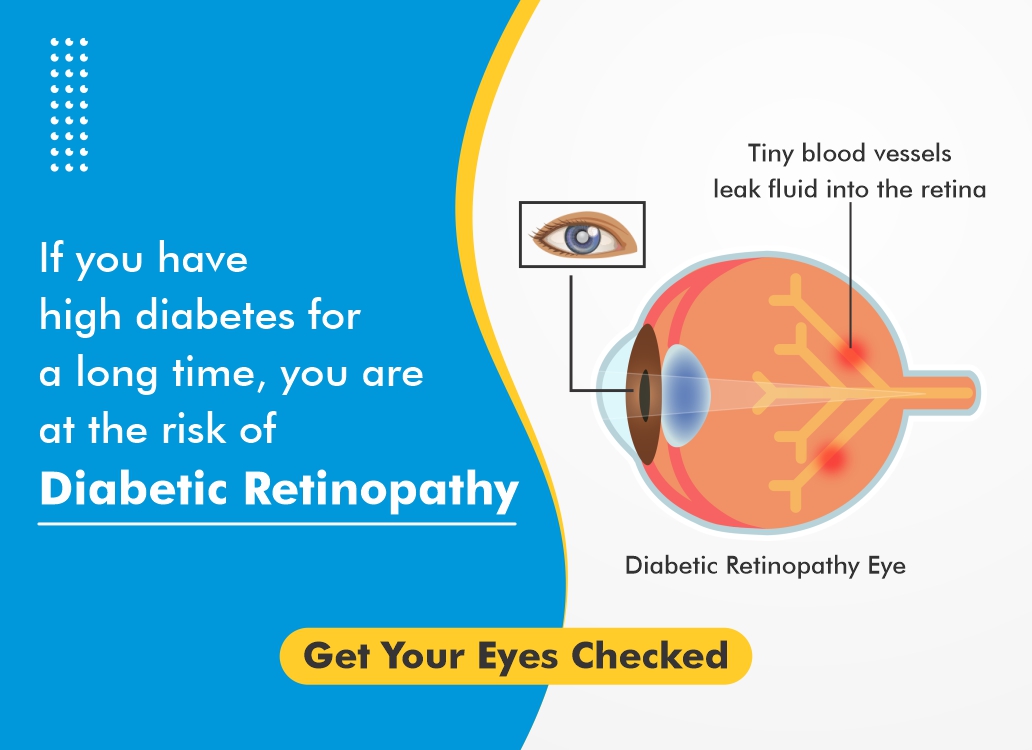 Diabetic Retinopathy: Symptoms, Causes, & Treatment