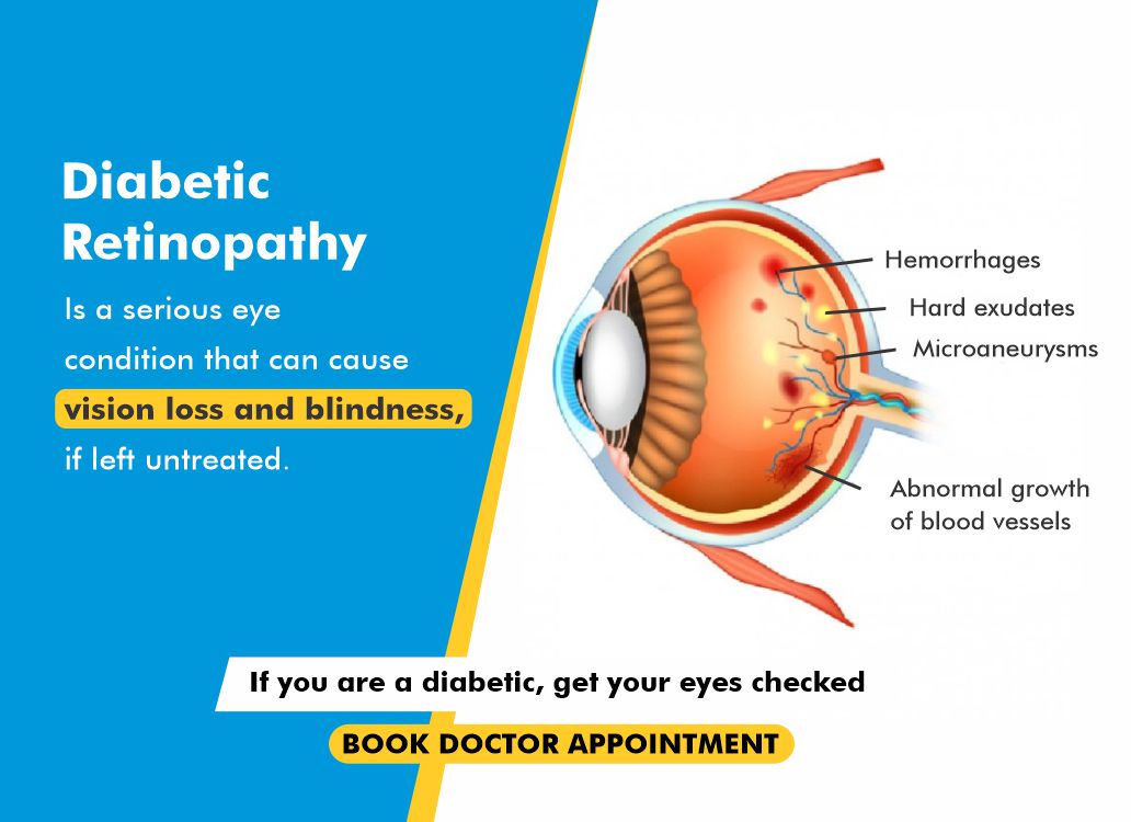 Diabetic Retinopathy Treatment | Prevent Vision Loss